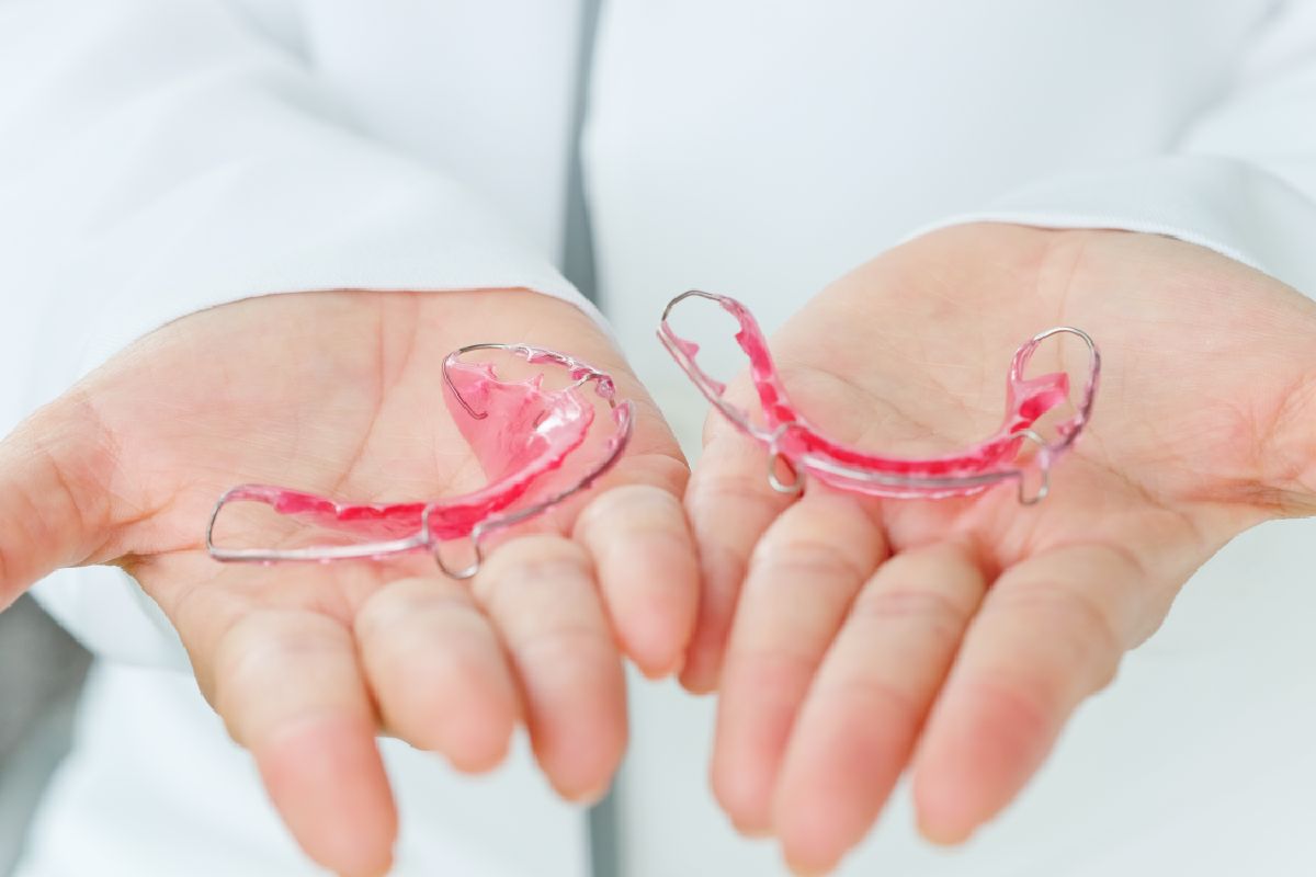 Do You Have to Wear Retainers Forever After Braces? What to Know